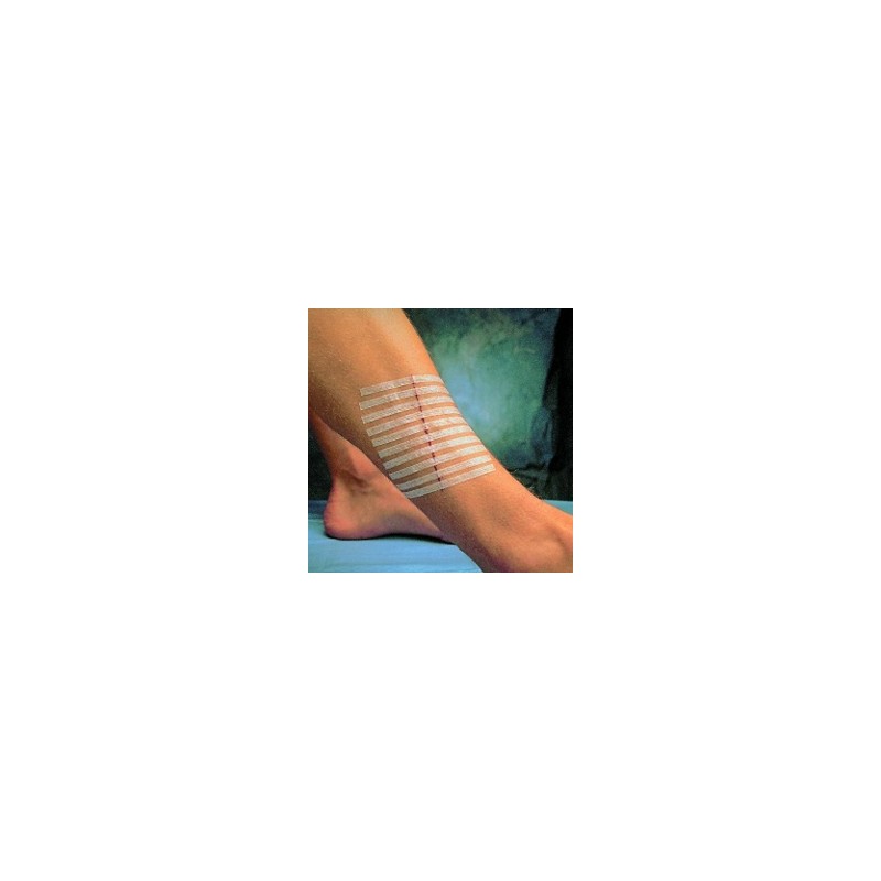 SUTURES 3M STERI STRIP 100x6mm-ORANGE-BOITE 50 SACHETS STERILES DE 10